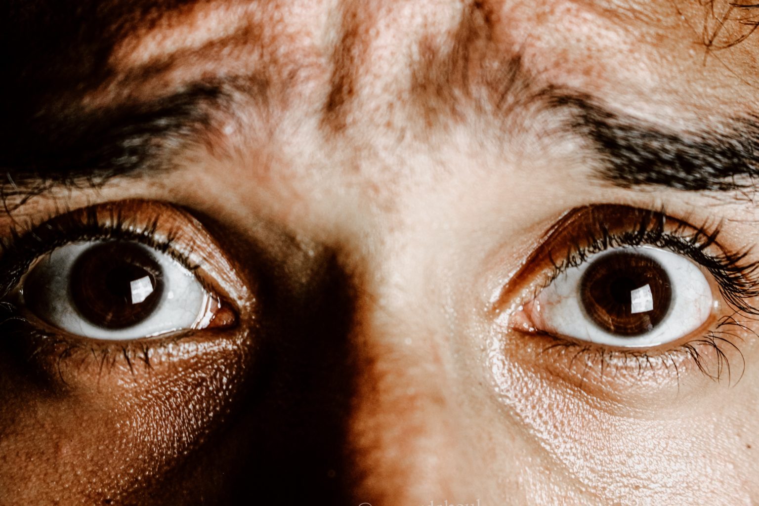 What Is Exposure Therapy Health Brain And Neuroscience